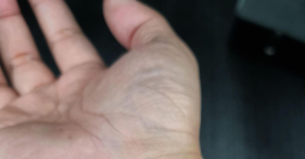 Pushers digging into my skin | WatchCrunch