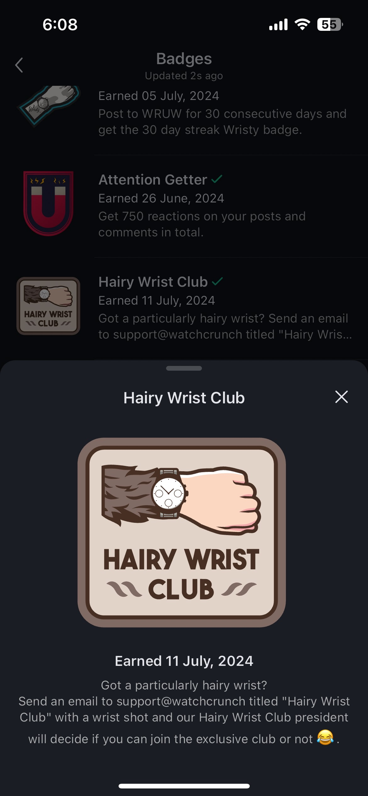 New Member of the Hairy Wrist Club 😆 | WatchCrunch