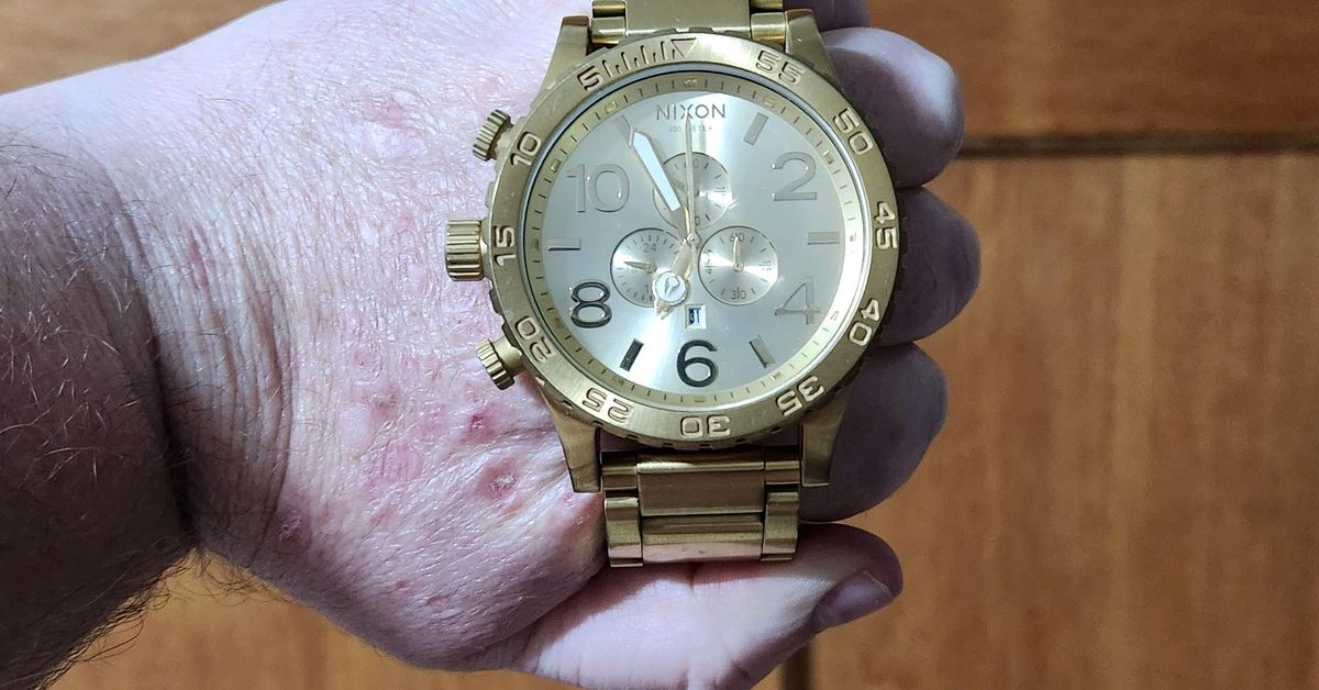 Left side crown | WatchCrunch