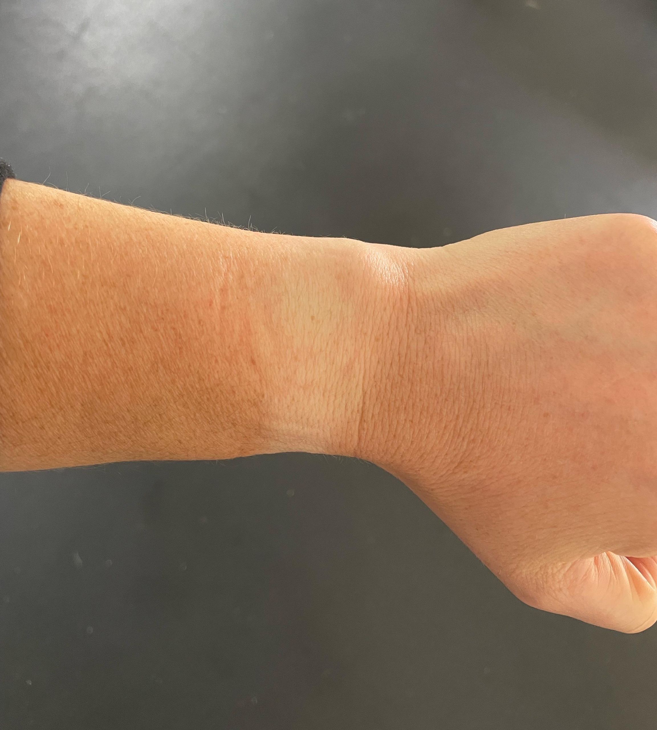 show me your watch tan 😂😎 | WatchCrunch