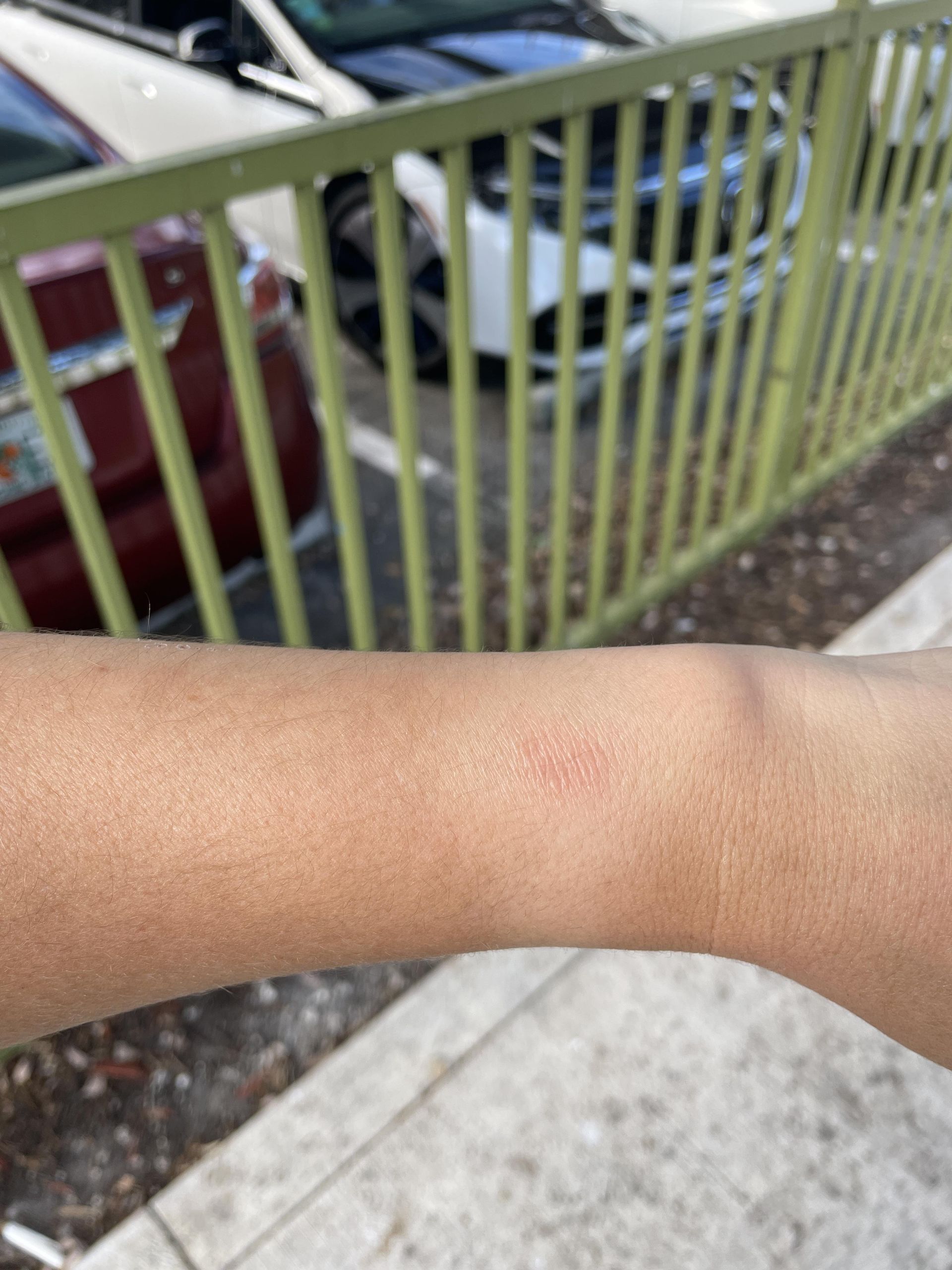 Rashes under my watch | WatchCrunch